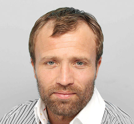 Micky Gray Hair Transplant Results | Farjo Hair Institute