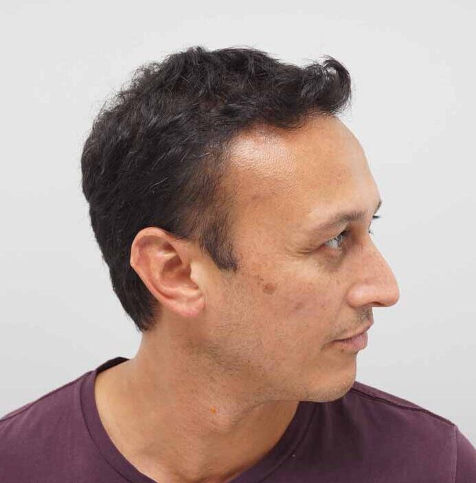 Chris Bisson, actor | Farjo Hair Institute