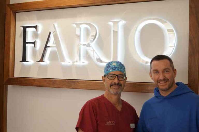 Anthony Quinlan, Actor | Results | Farjo Hair Institute